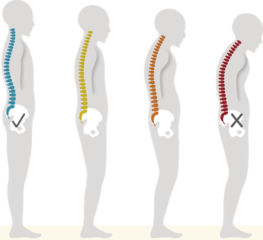 Why Poor Posture Can Ruin Your Golf Game