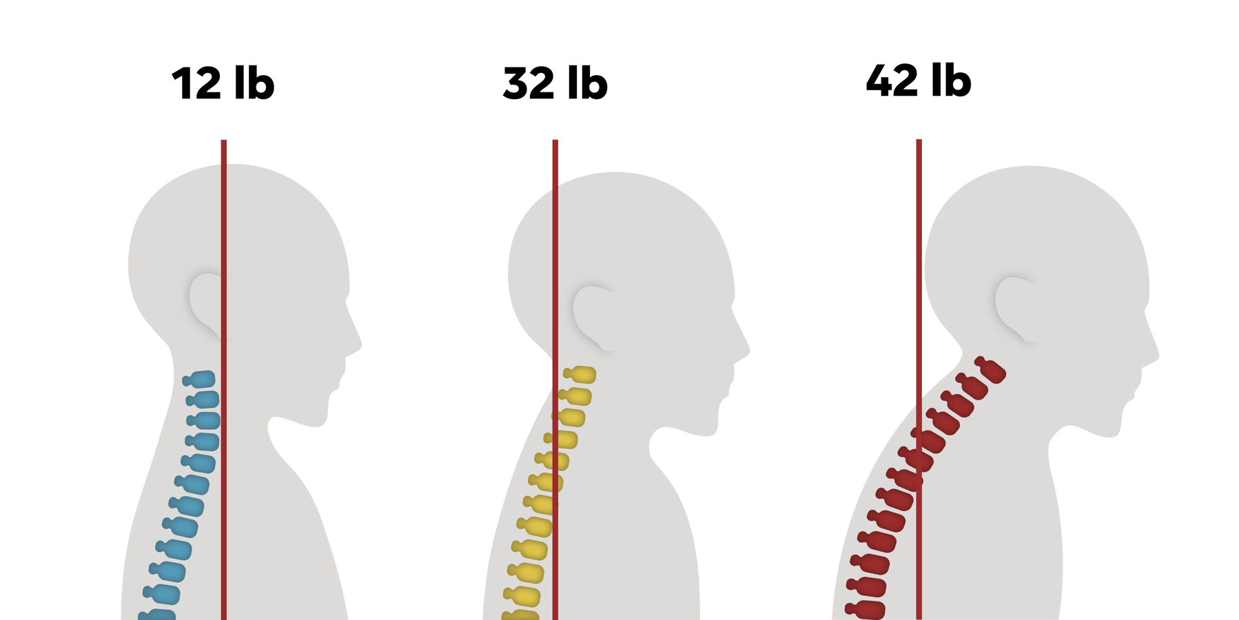 What Is Tech Neck? Symptoms, Exercises, and Treatment