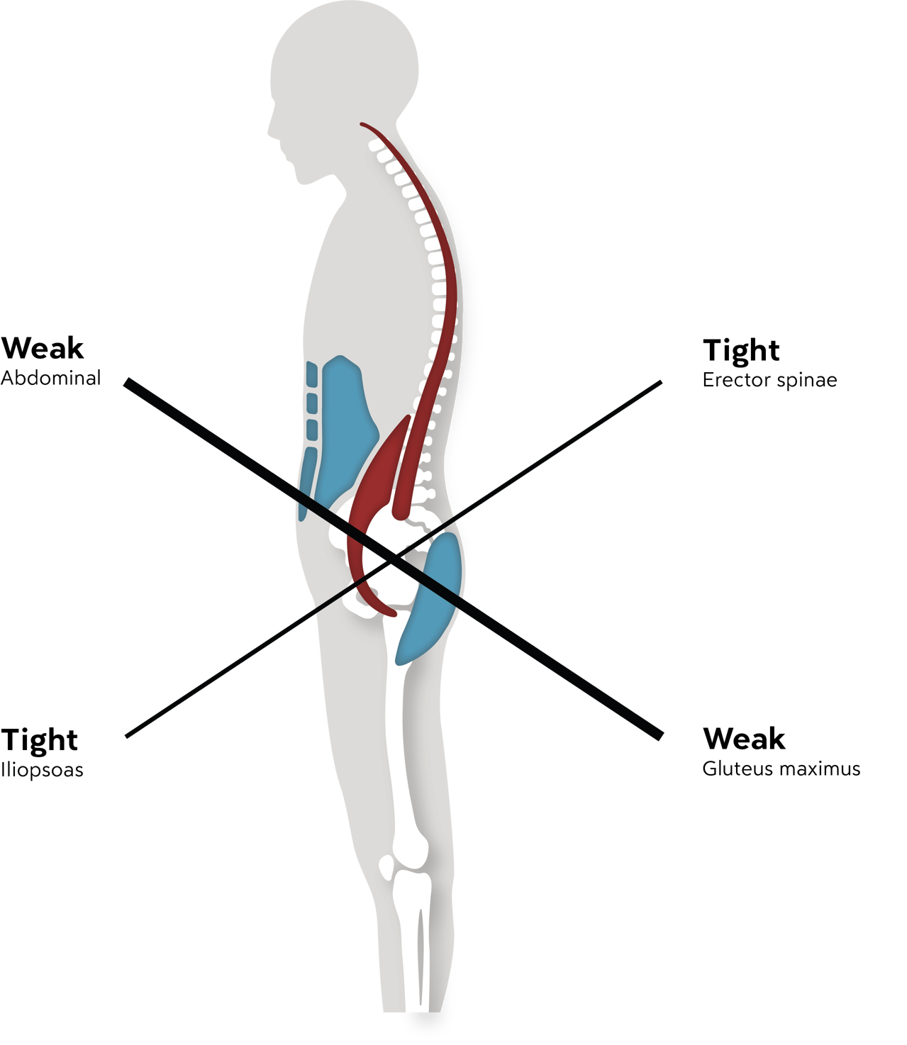 What Is Tech Neck? Symptoms, Exercises, and Treatment