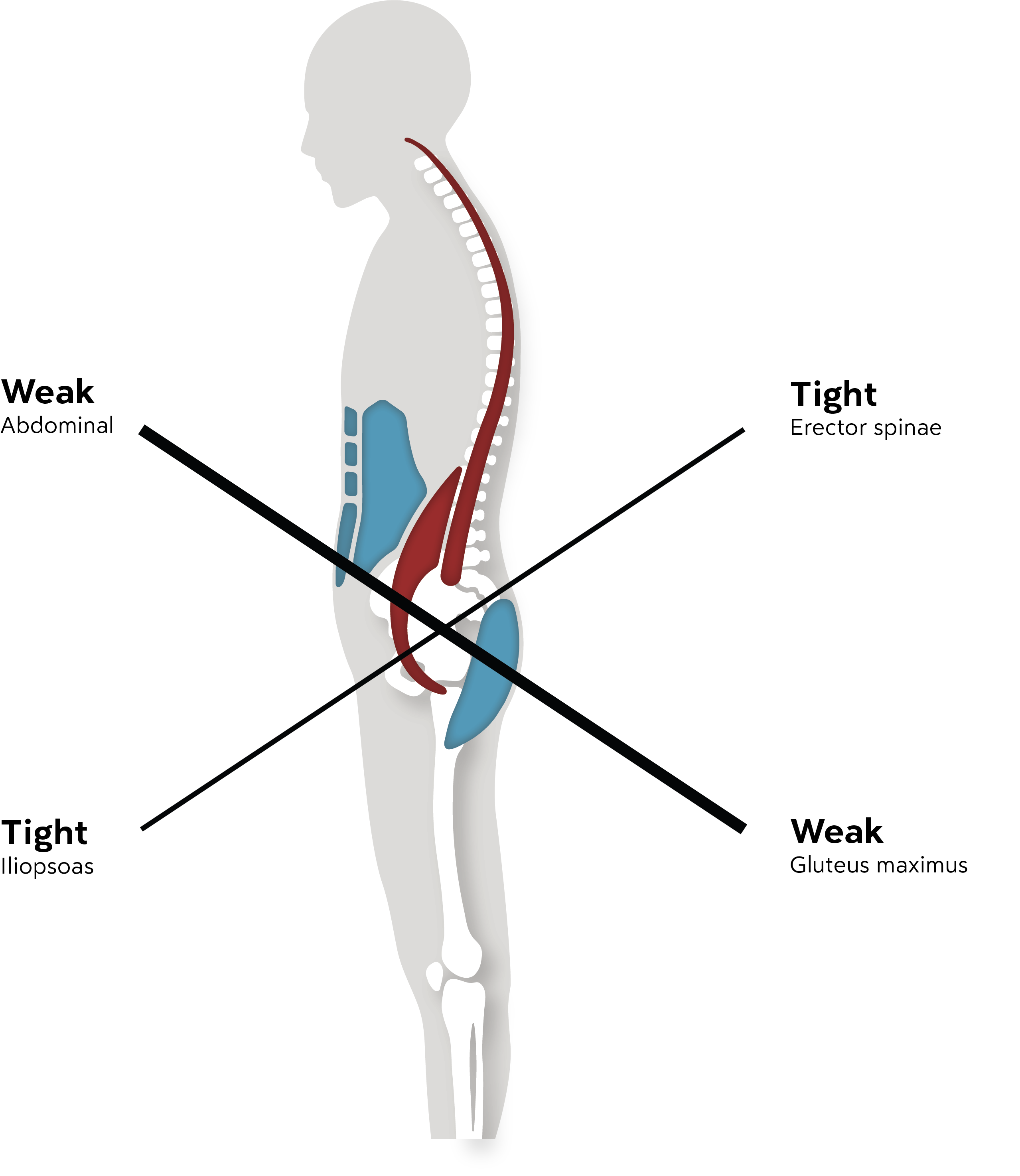 What Is Tech Neck? Symptoms, Exercises, and Treatment