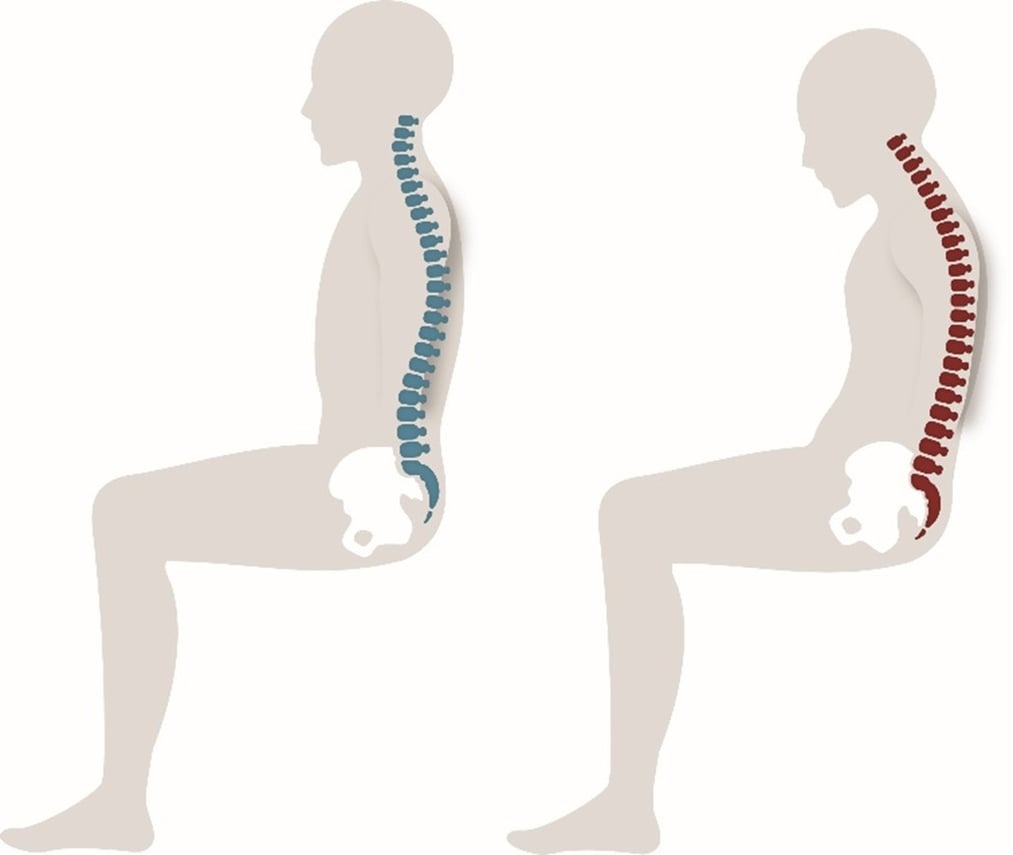 Thoracic Decompression: The importance of sitting posture