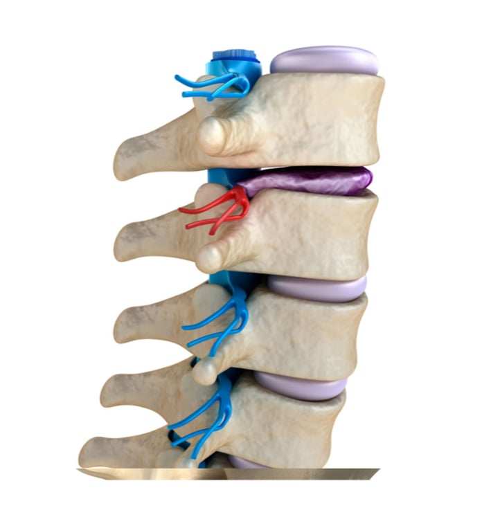 From Slouch to Strain: How Poor Posture Fuels Degenerative Disc Disease