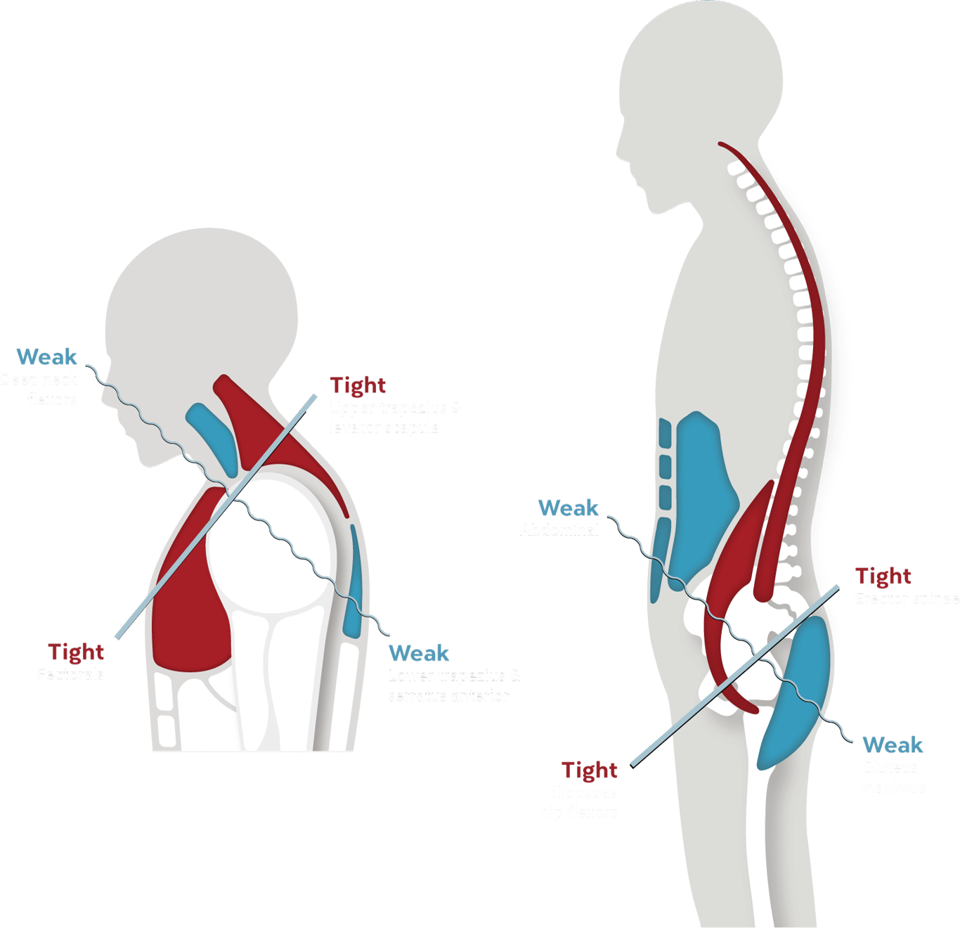 How To Stop Slouching Easily Improve Your Posture