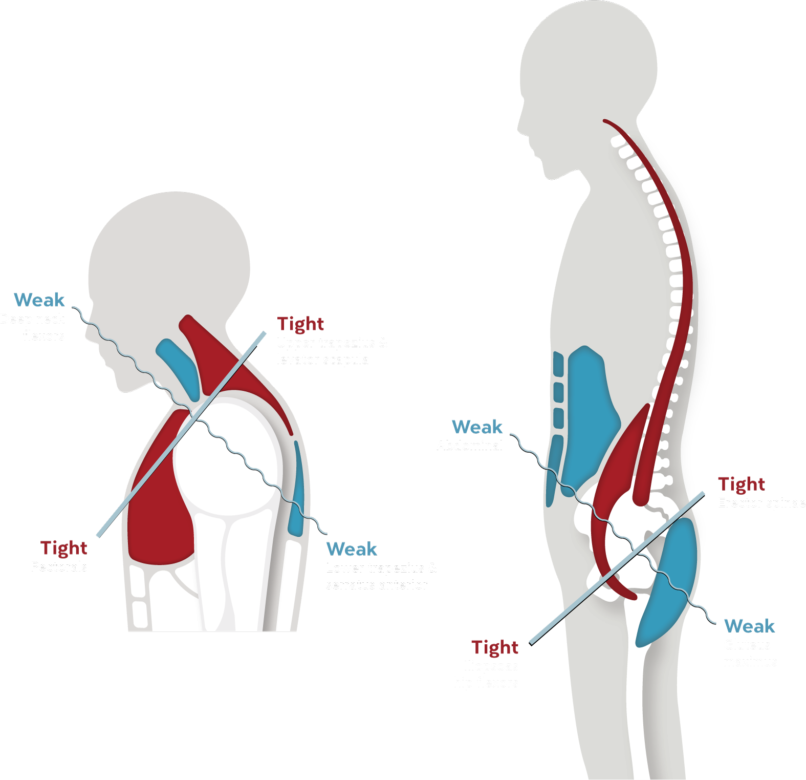 How To Stop Slouching! Easily Improve Your Posture